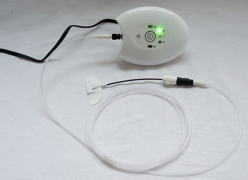 AAKP Innovator Series: Redsense Medical – AAKP