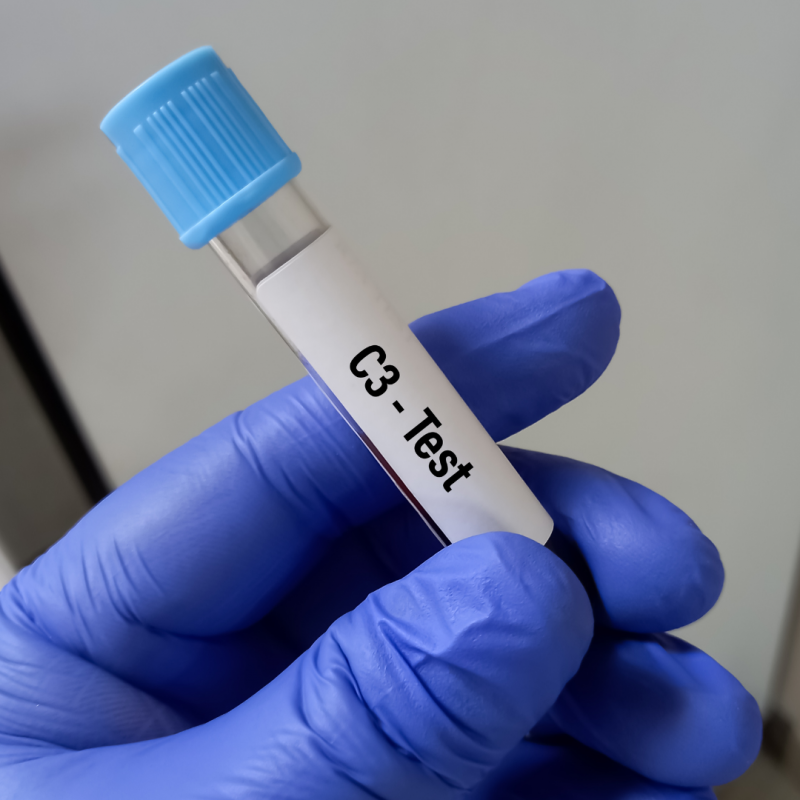 Understanding Complement 3 glomerulopathy (C3G) – AAKP