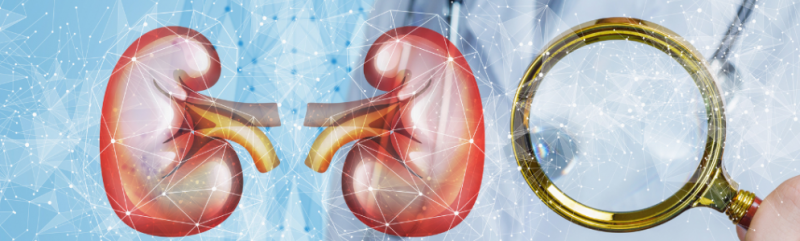Understanding Complement 3 glomerulopathy (C3G) – AAKP